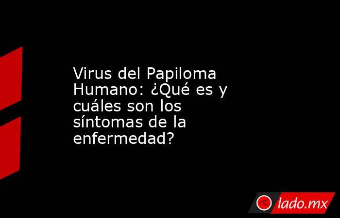 Virus del Papiloma Humano: ¿Qué es y cuáles son los síntomas de la ...